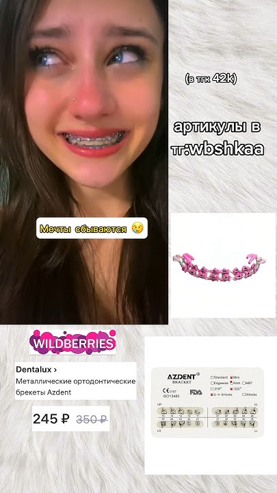 накладные брекеты с ВБ за копейки 🤯 #врек #брекеты #видео - YouTube