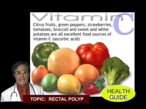 Overcooked Food and Rectal Polyps Dr. Warfe Tupas Engracia's - YouTube