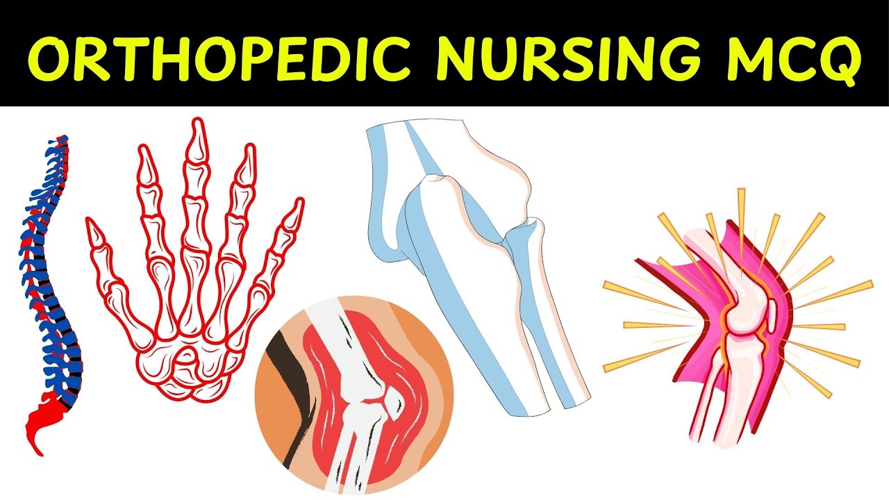 ORTHOPEDIC NURSING MCQ | Practice MCQs QUIZ with Rationale ANSWERS | - YouTube
