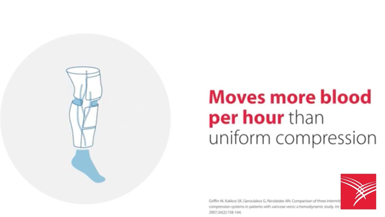 Kendall SCD SmartFlow™ Vascular Refill Detection Technology - YouTube