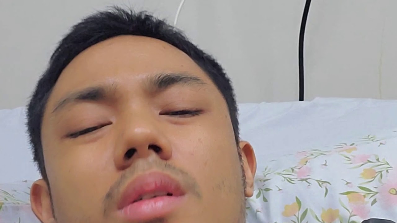 PINOY PHYSICAL THERAPIST FRACTURE RECOVERY pt. 1 - YouTube