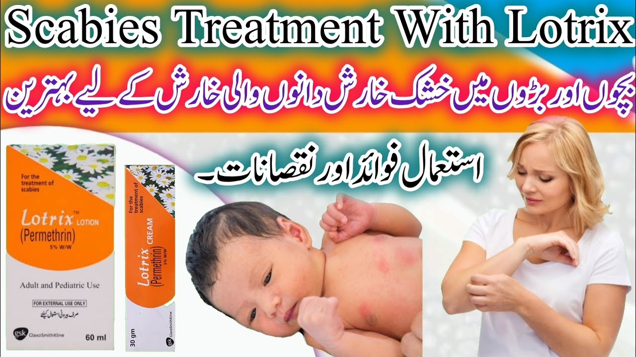 Lotrix Lotion /Lotrix Cream Uses Benefits & Side effect In Urdu ...