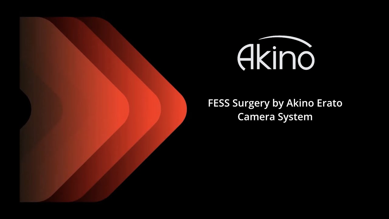 FESS Surgery by Akino Erato Camera System - YouTube