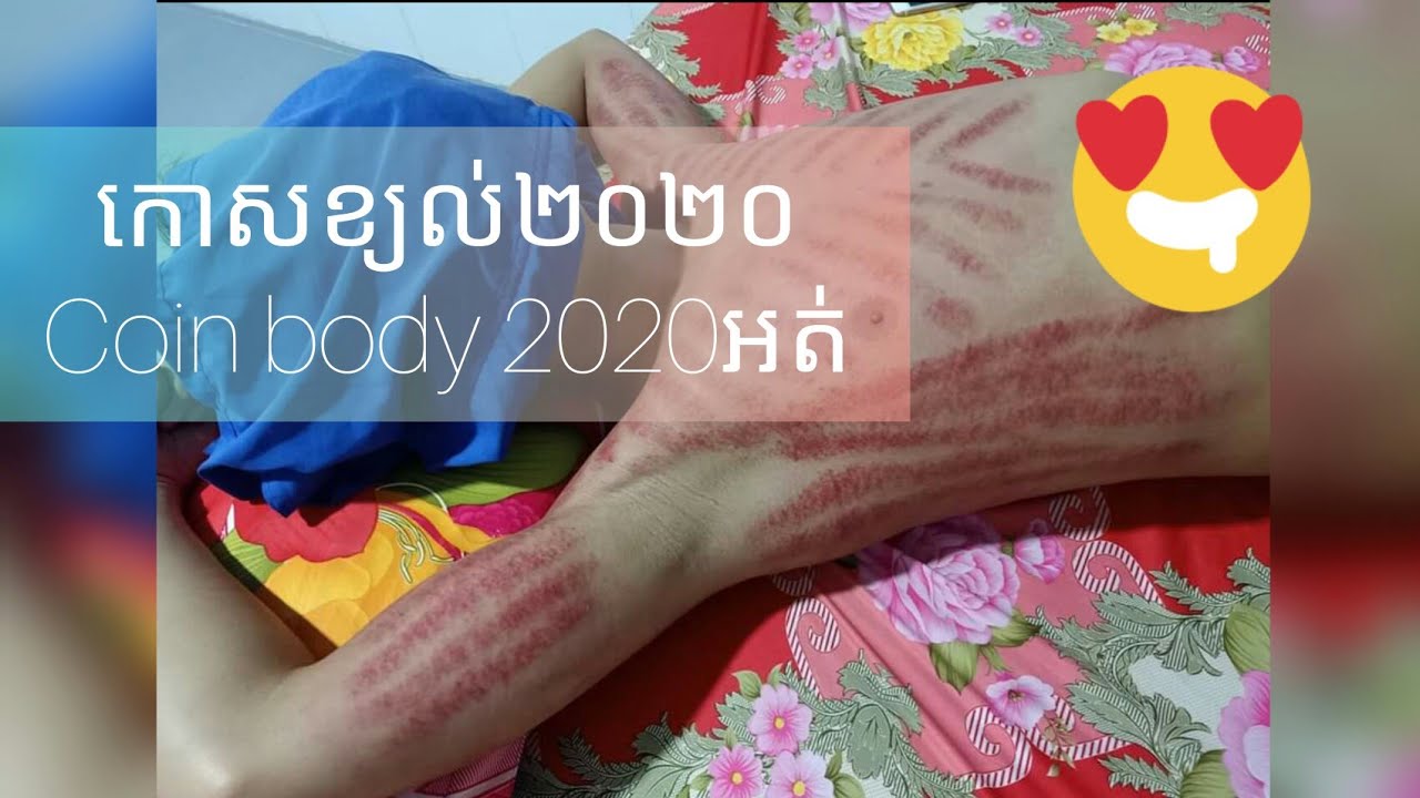 Coining body- Kos kyol- កោសខ្យល់ - YouTube