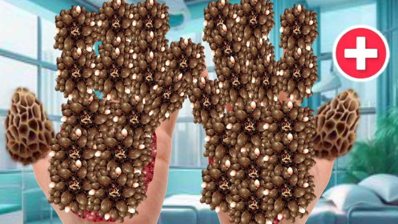 ASMR Removal Dog Tick||How To Remove Dog Tick||Deep Cleaning ASMR ...