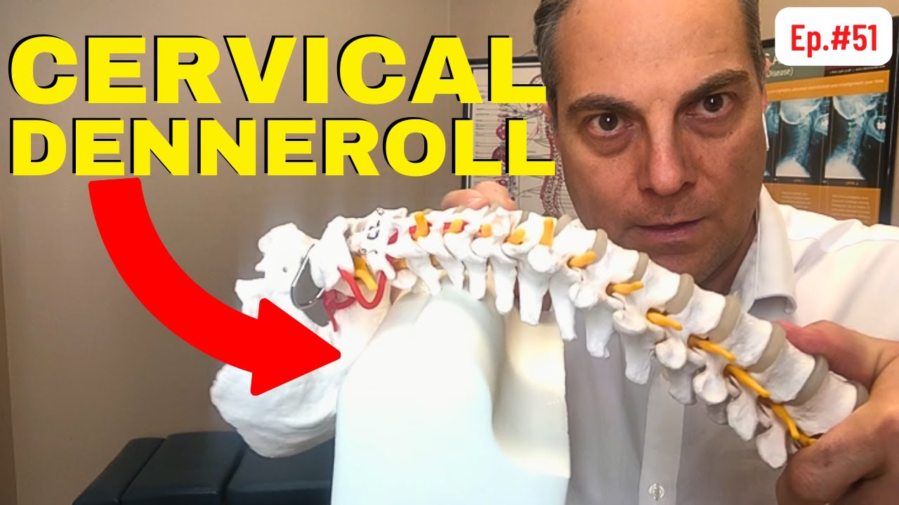Ep51. Cervical Denneroll, How & Where Do I Get One? | Dr. Walter ...