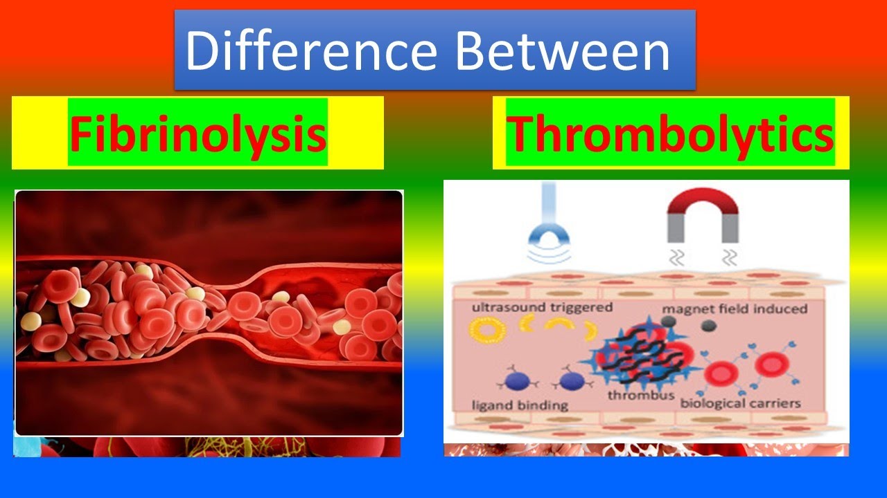 Difference between Fibrinolysis and Thrombolytics - YouTube