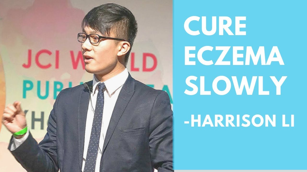 Cure Eczema Slowly - Interview with Harrison Li - YouTube