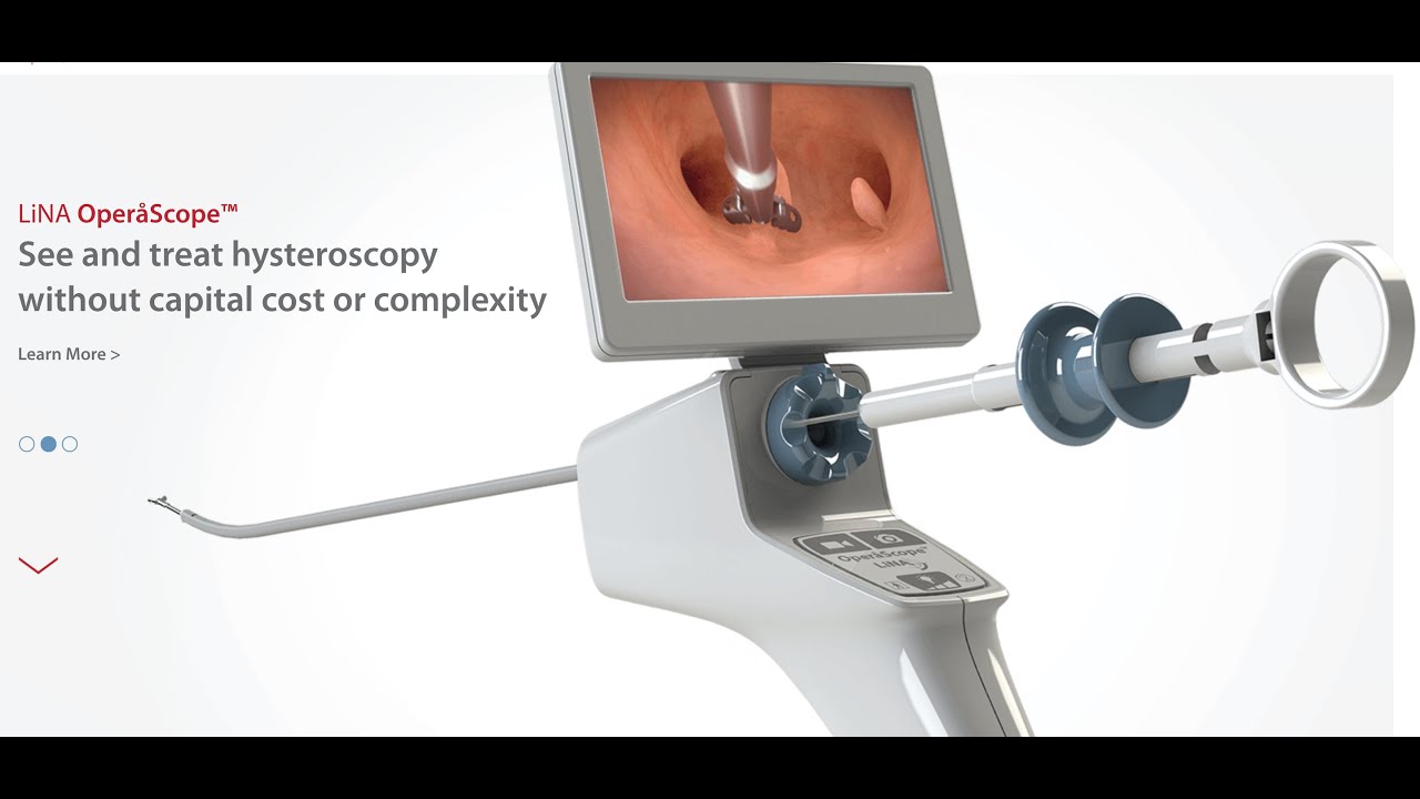 Bladder Botox with Operascope - YouTube