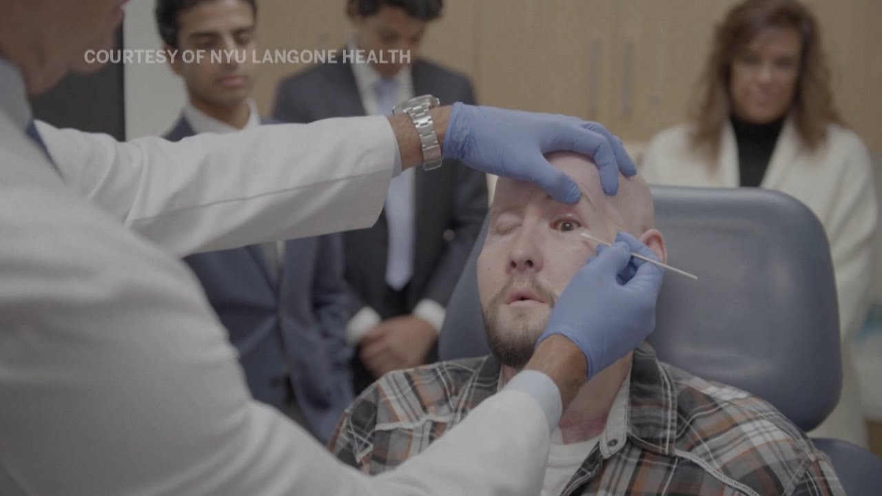 Surgeons Announce World’s First Eye Transplant | VOA News - YouTube