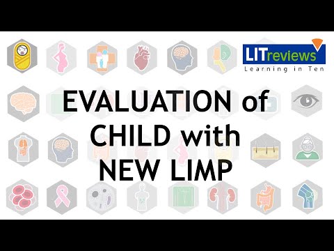 Evaluation of the Child with a New Limp - YouTube
