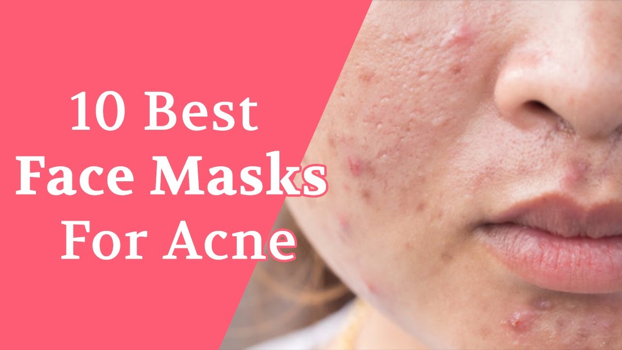 10 Best Face Masks for Acne & Pimples | Ideal to Treat Oily & Acne ...