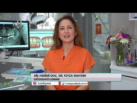 Çene eklemi ağrıları, yanak ağrısı, baş-boyun ağrısı, kulak ağrısı, splint, masseter botox