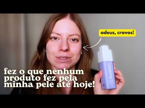 ADAPALENATO da Creamy: Resenha de 3 meses de uso + por que não uso somente Functional Care!