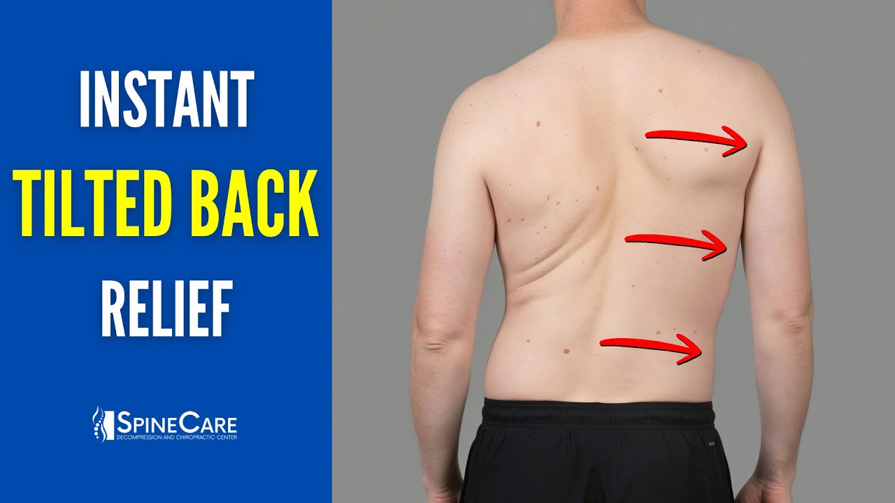 Back Leaning to One Side? Fix It in 60 SECONDS. - YouTube