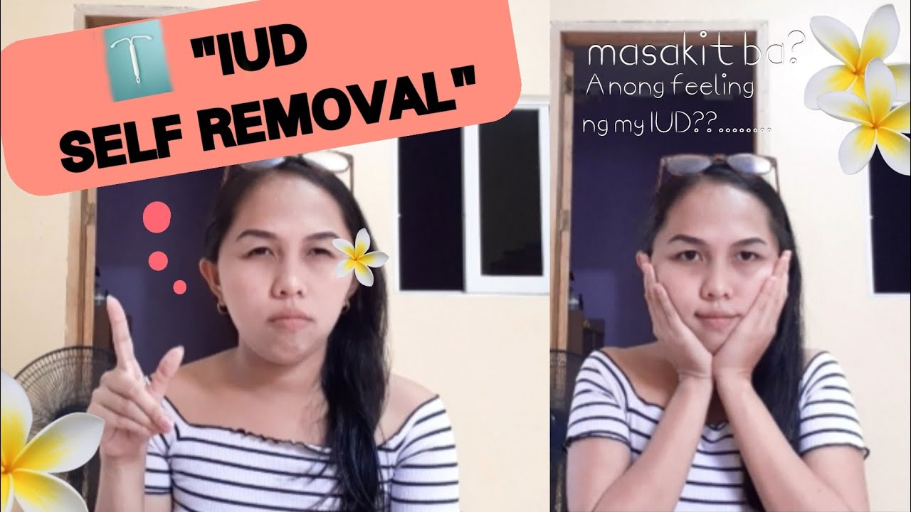 IUD SELF REMOVAL/MASAKIT BA?/IUD EXPERIENCE/INTRAUTERINE DEVICE - YouTube