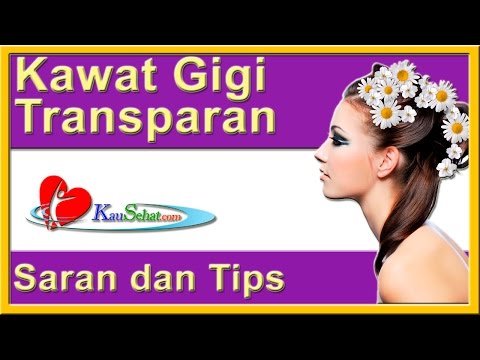 Kawat Gigi Transparan - VIDEO Kesehatan Hidup Wanita Indonesia