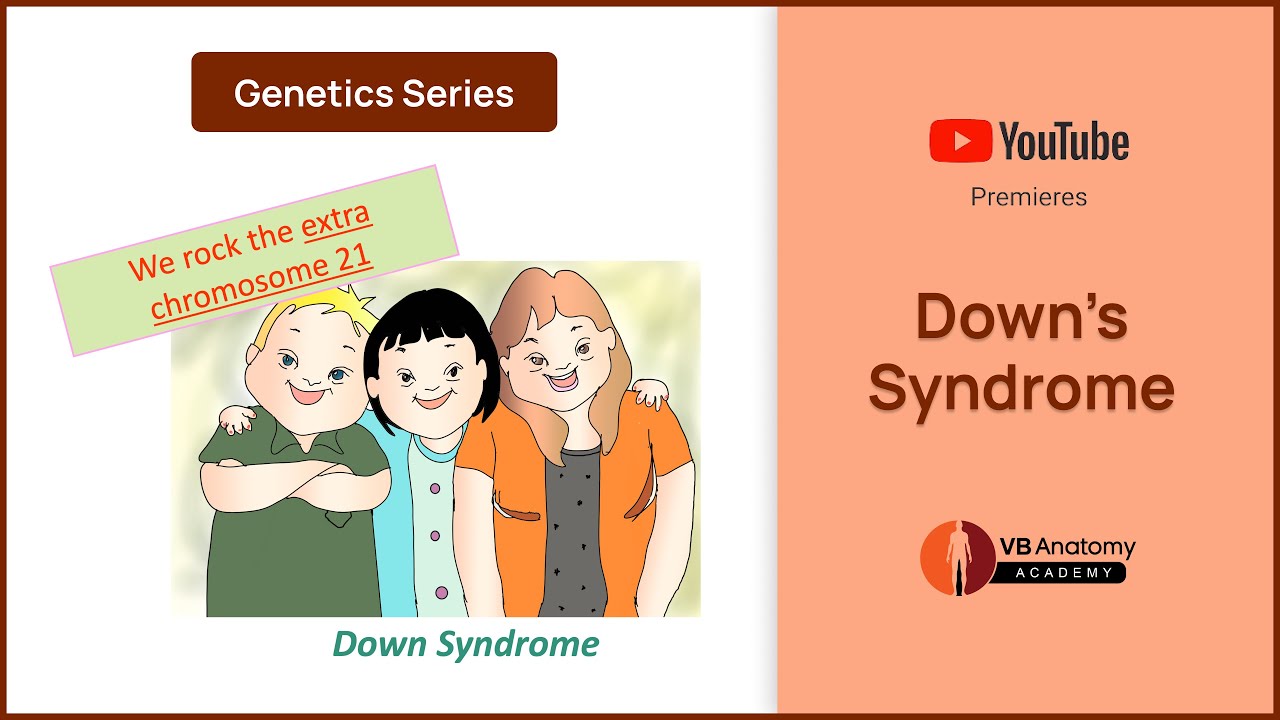 Understanding Trisomy Disorders: Down, Edward's, and Patau's Syndromes ...