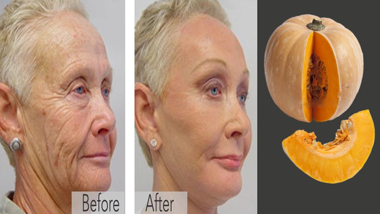 Pumpkin is a million times stronger than Botox, it eliminates wrinkles ...