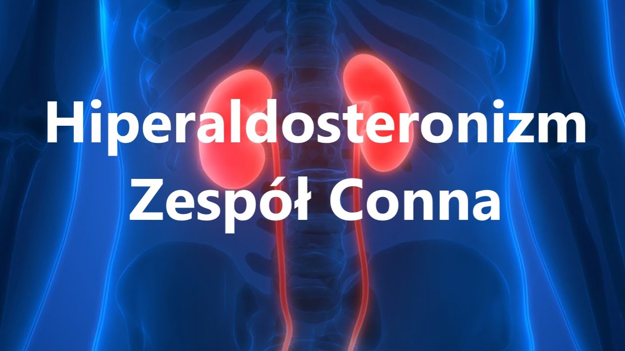 Hiperaldosteronizm: Zespół Conna [Medycyna w prosty sposób cz.7] - YouTube