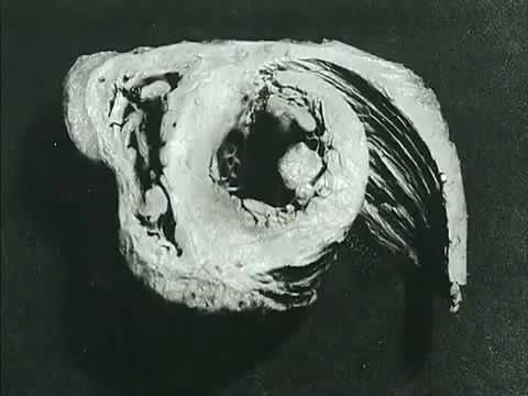 The Body ElectroMagnetic field is generated by the Helical Heart ...