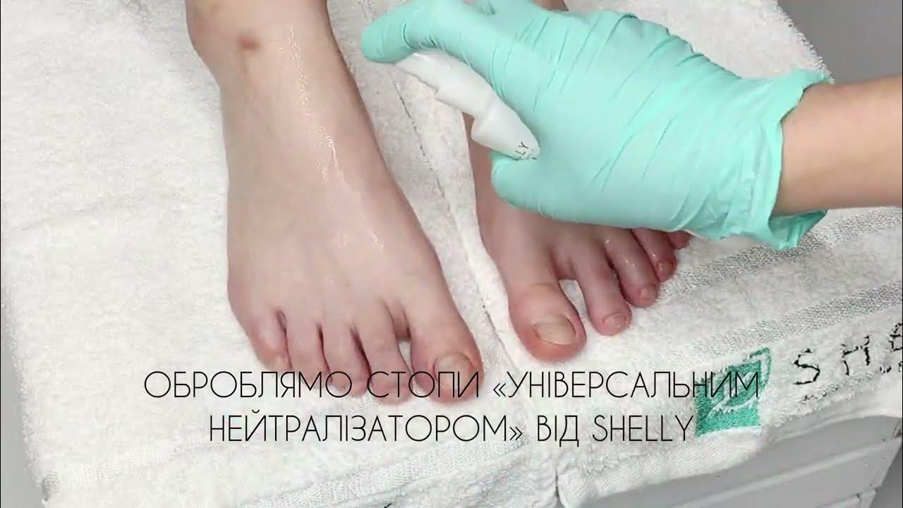 Гель кератолітик для видалення мозолів і натоптишів Мяке лезо Shelly 200 мл Youtube