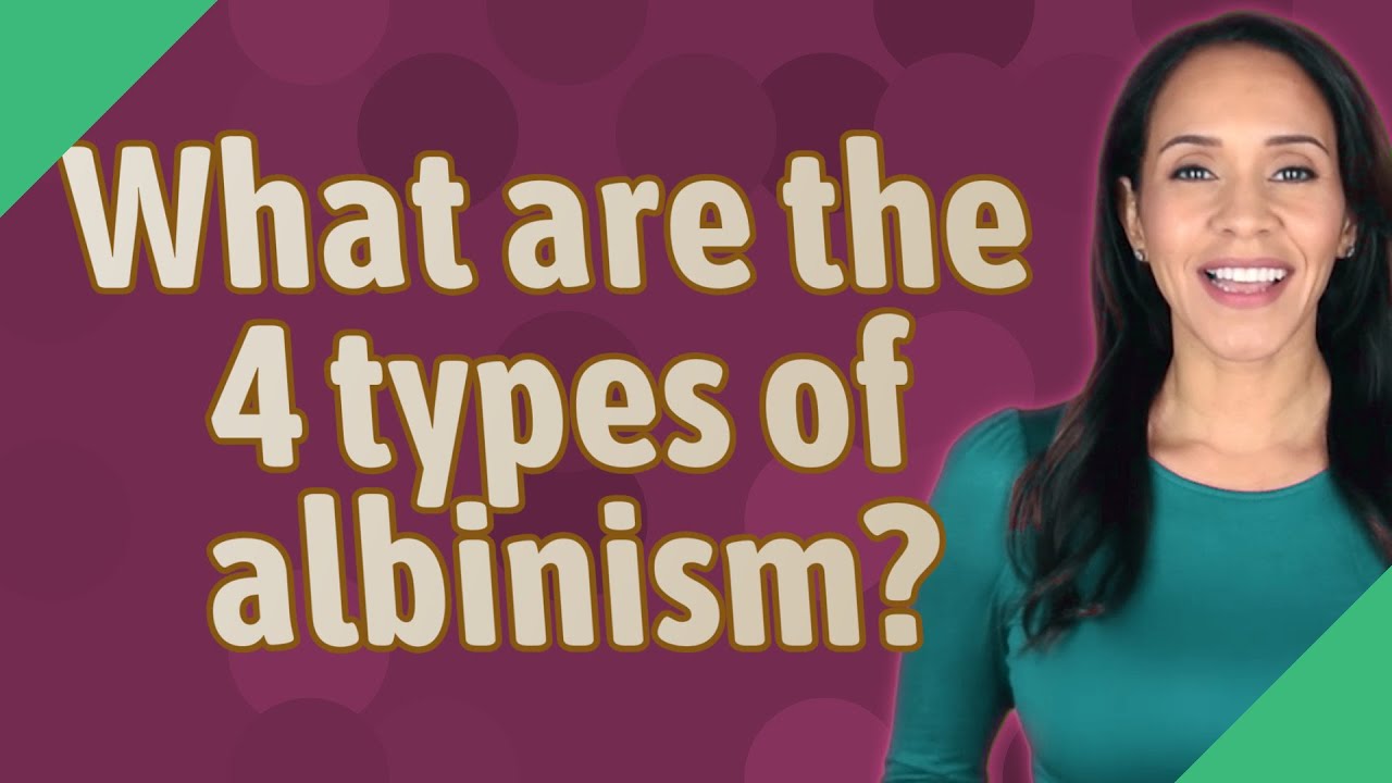 What are the 4 types of albinism? - YouTube