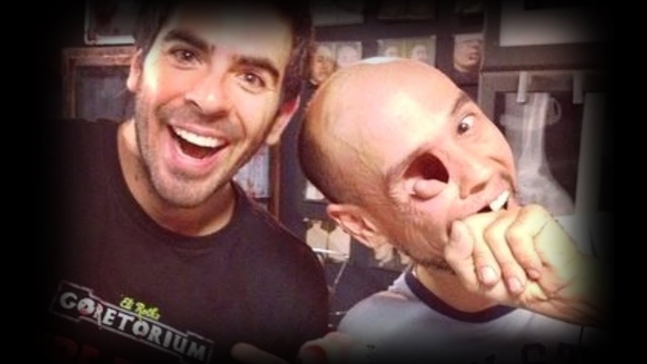 Top 5 [ Impactante ] Personas con condiciones sumamente extrañas que ...