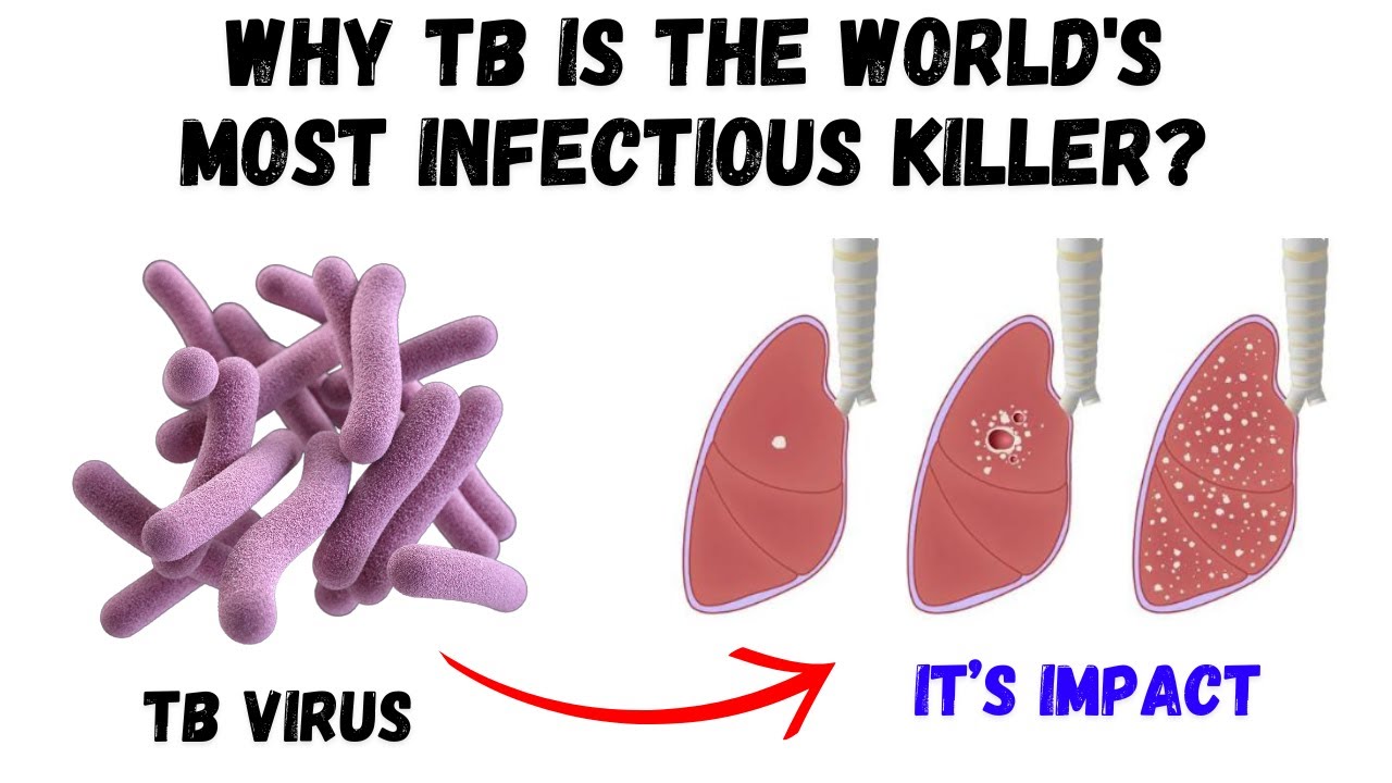Why Tuberculosis (TB) is the world's most infectious killer? - YouTube