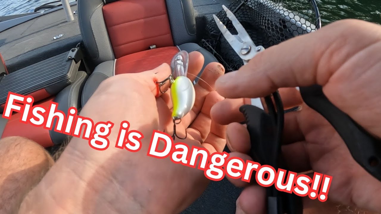 Fishing is Dangerous. I hooked myself bad. #fishing - YouTube