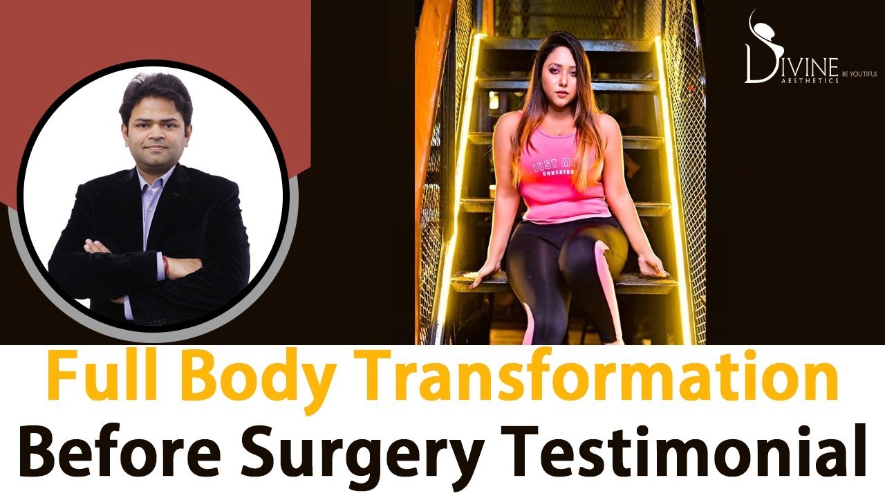 Full Body Transformation Marking & Before Surgery Testimonial - YouTube