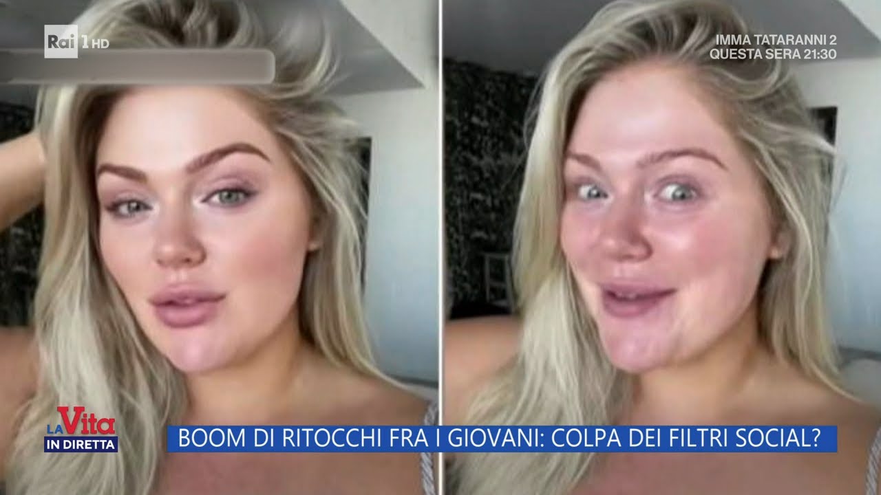 Boom di ritocchi fra i giovani: colpa dei filtri social? - La Vita in diretta - 04/04/2023 - YouTube