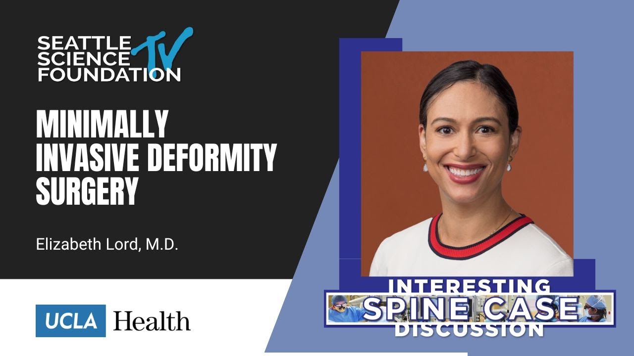 Minimally Invasive Deformity Surgery - Elizabeth Lord, MD - YouTube