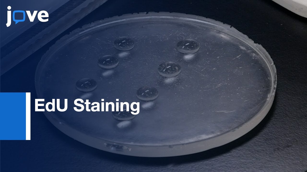 Mitochondrial DNA Replication Labelling by EdU Staining | Protocol ...