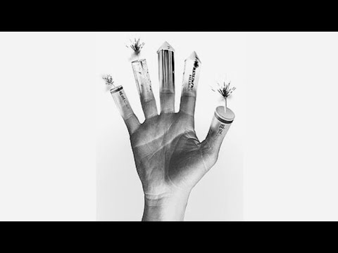 Firecracker Burst Hand Injury #handsurgeon #handinjury #trauma # ...