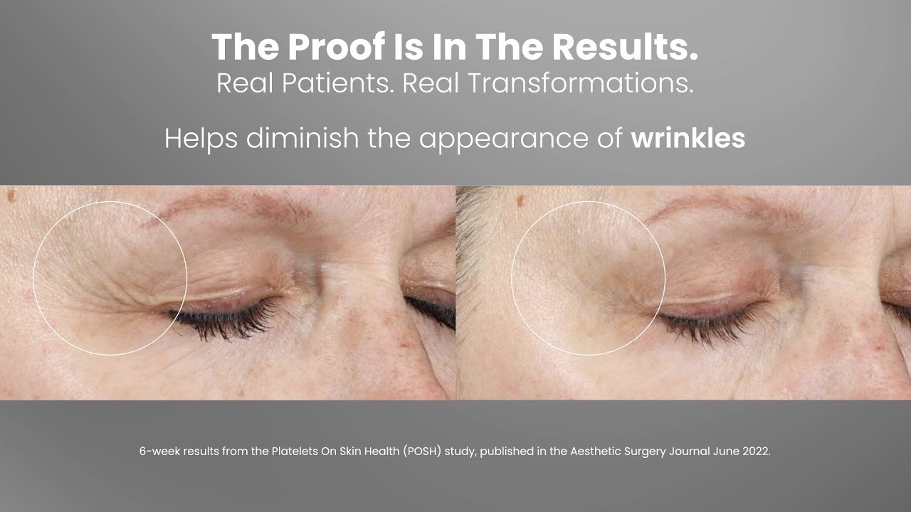 Meet the (plated) Collection - YouTube