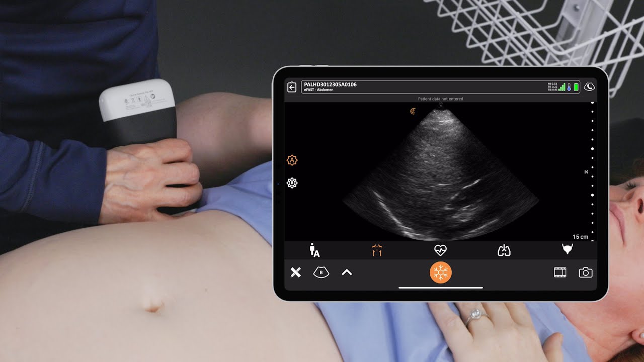 The eFAST Preset - YouTube