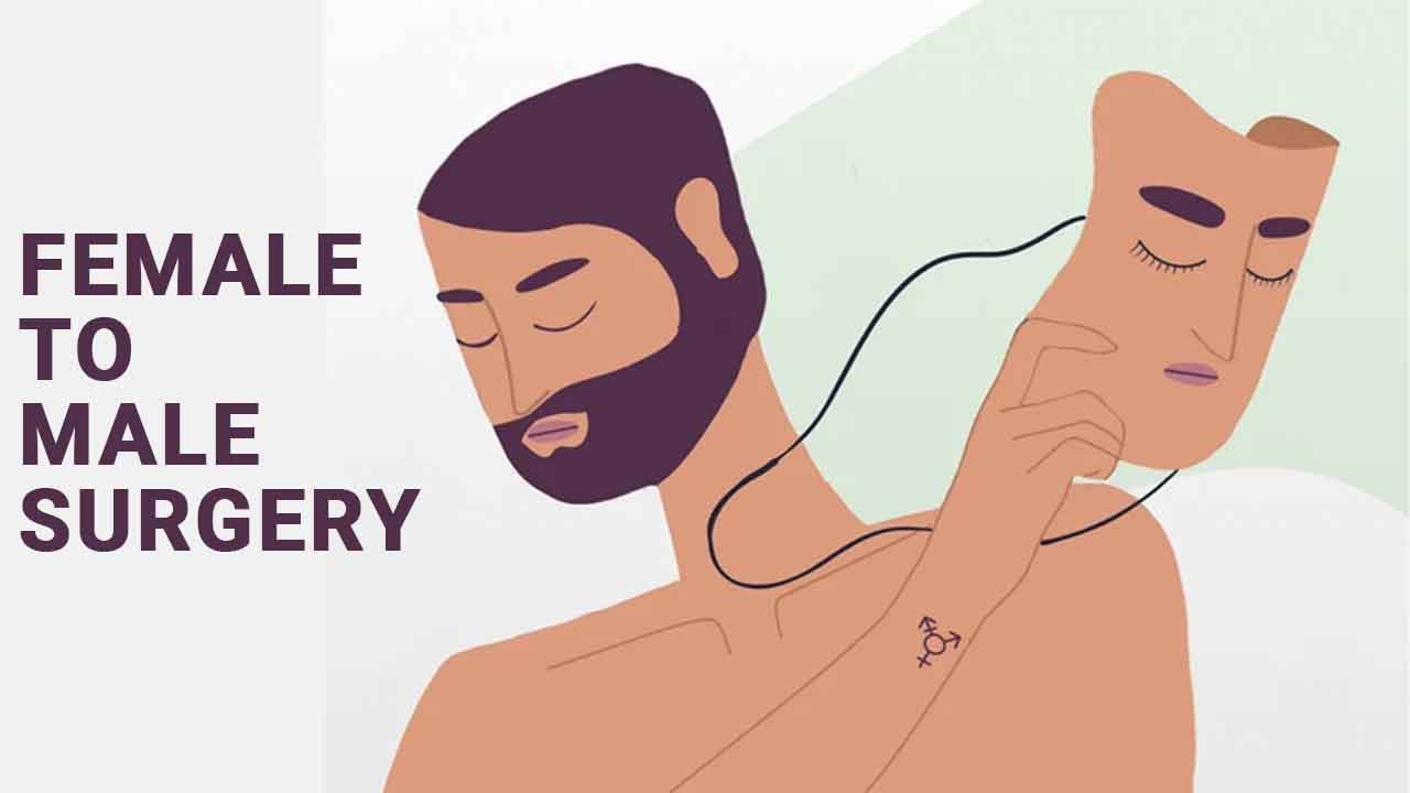 Keyhole FTM top Surgery + Skin tightening + Nipple reduction - YouTube