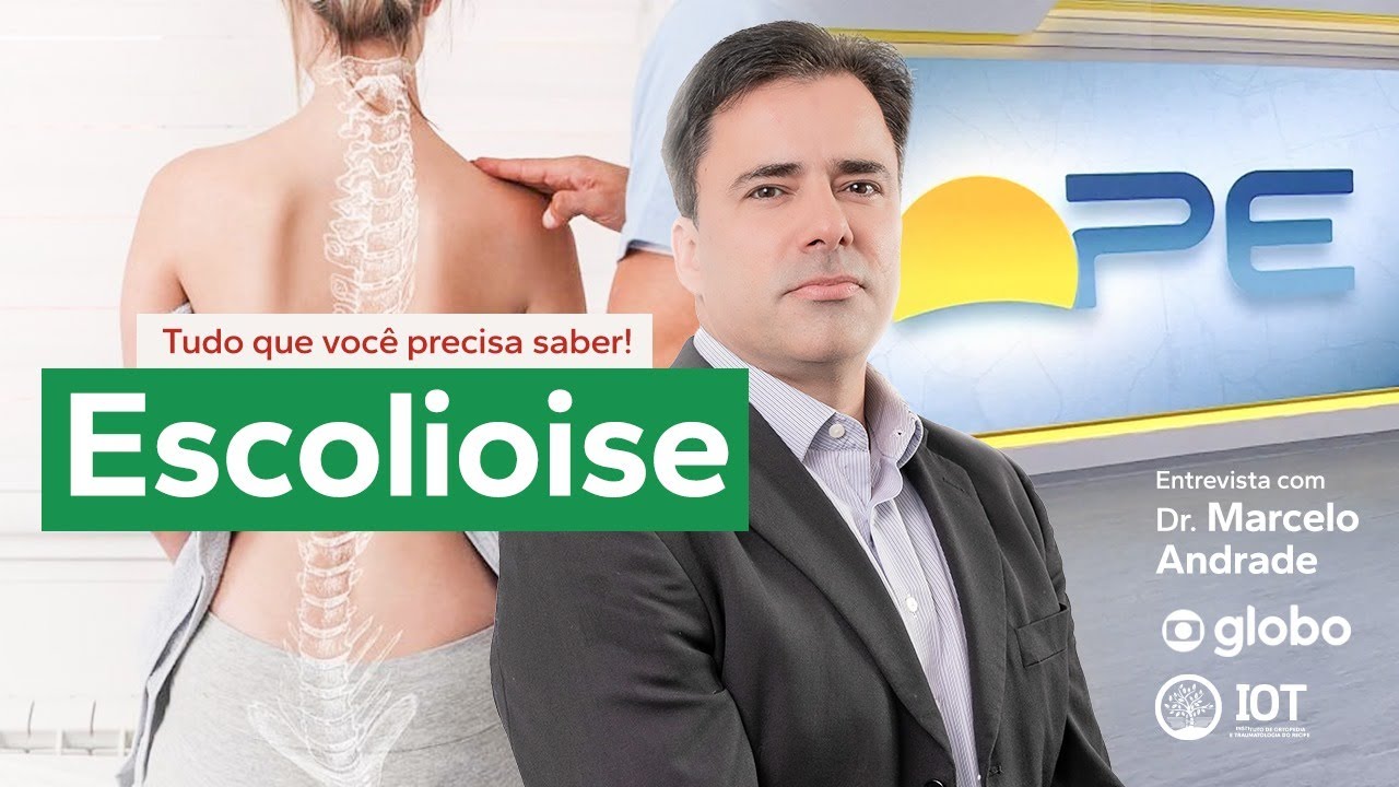 [IOT - RECIFE] - Dr. Marcelo Andrade conversa com bom dia PE sobre o ...