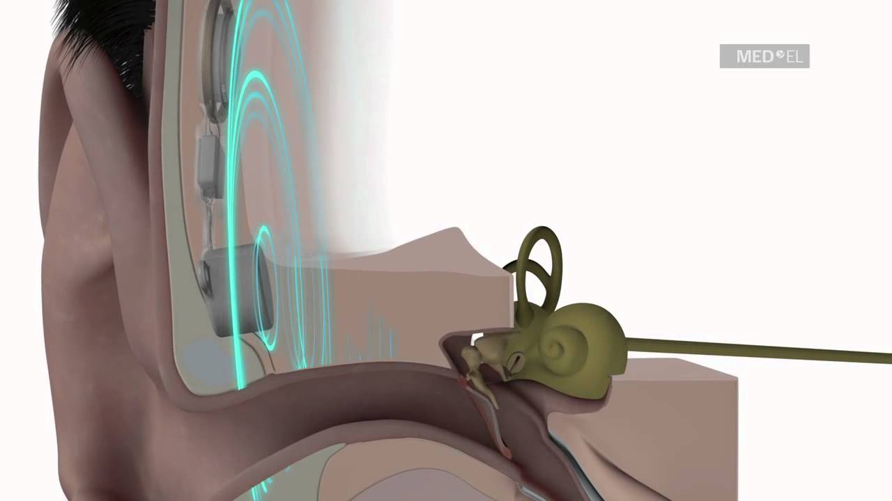 How the BONEBRIDGE works with Amadé Audio Processor - YouTube