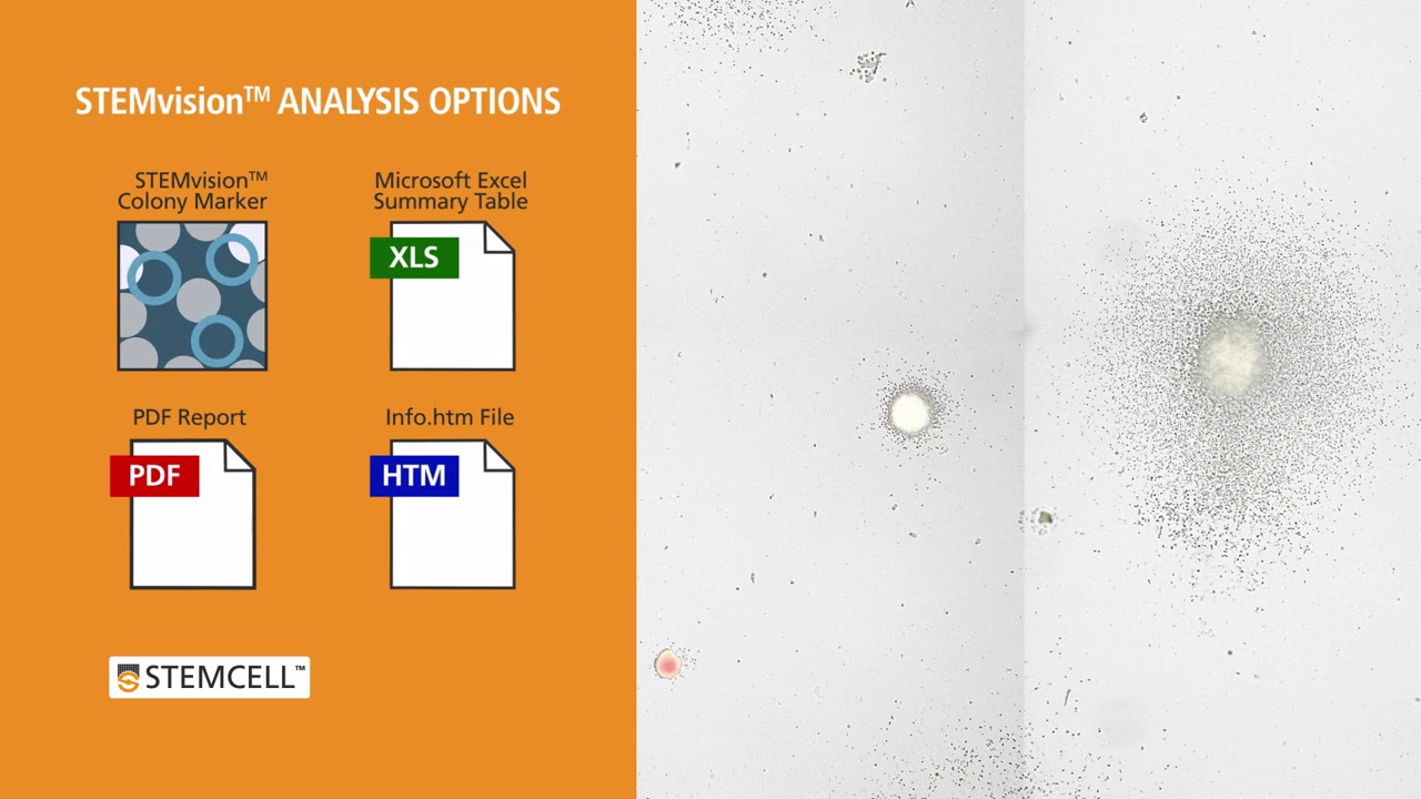 How to Standardize Hematopoietic Colony Counting with STEMvision™ - YouTube