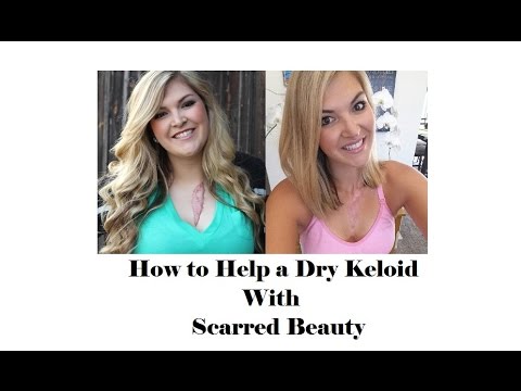 Great Lotion for Dry Keloid, Scar or Skin - YouTube