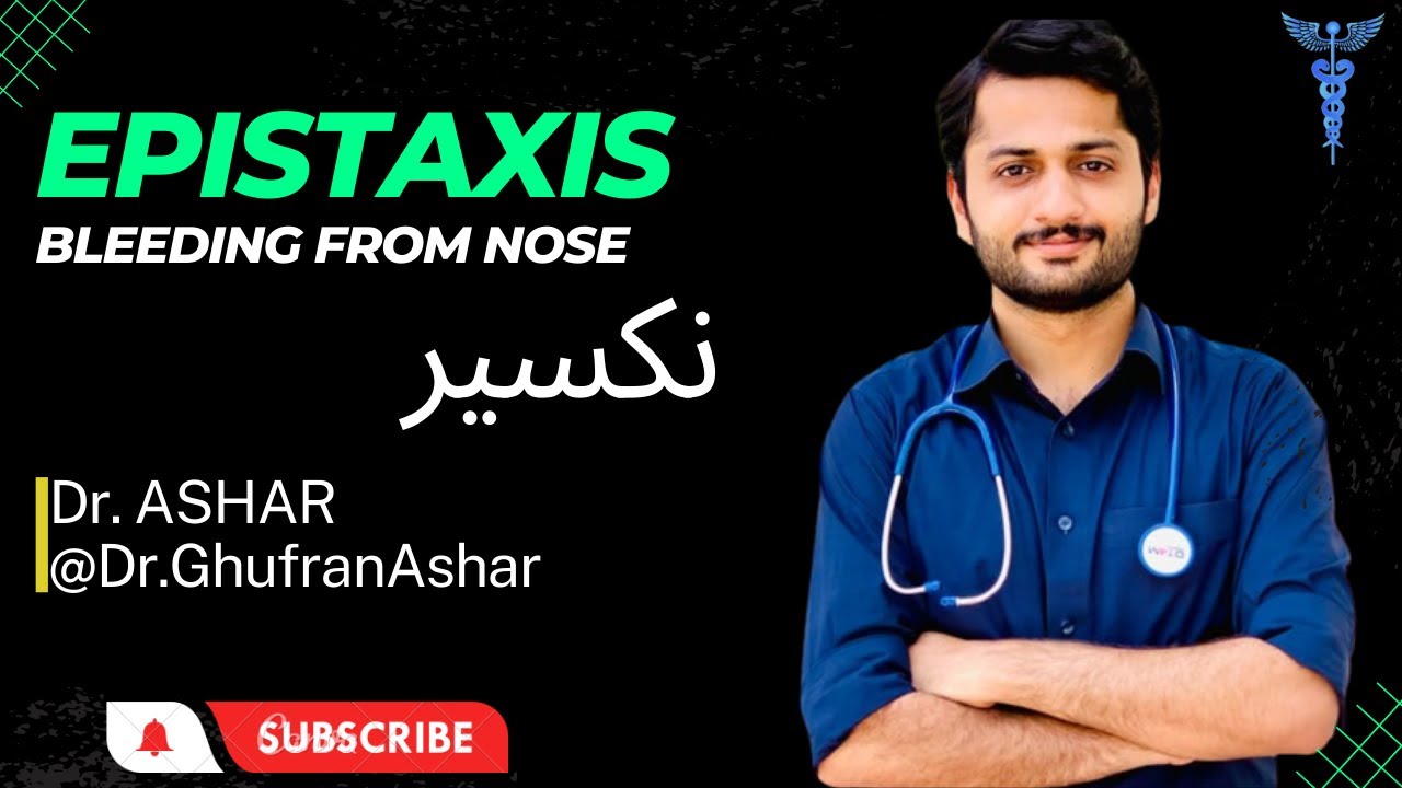 How to stop nose bleeding| nosebleed||nose bleeding||nose bleed||how to ...