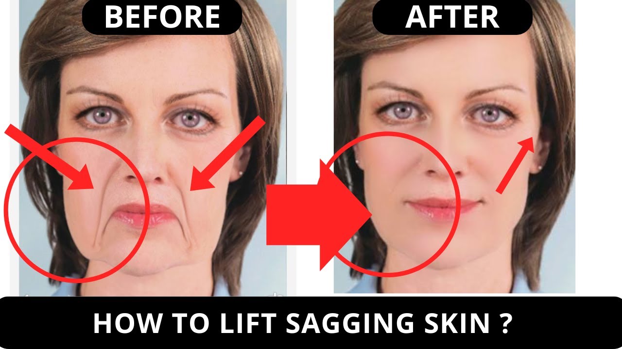 Anti Aging Face Exercises For Sagging Skin Jowls Cheeks Laugh Lines