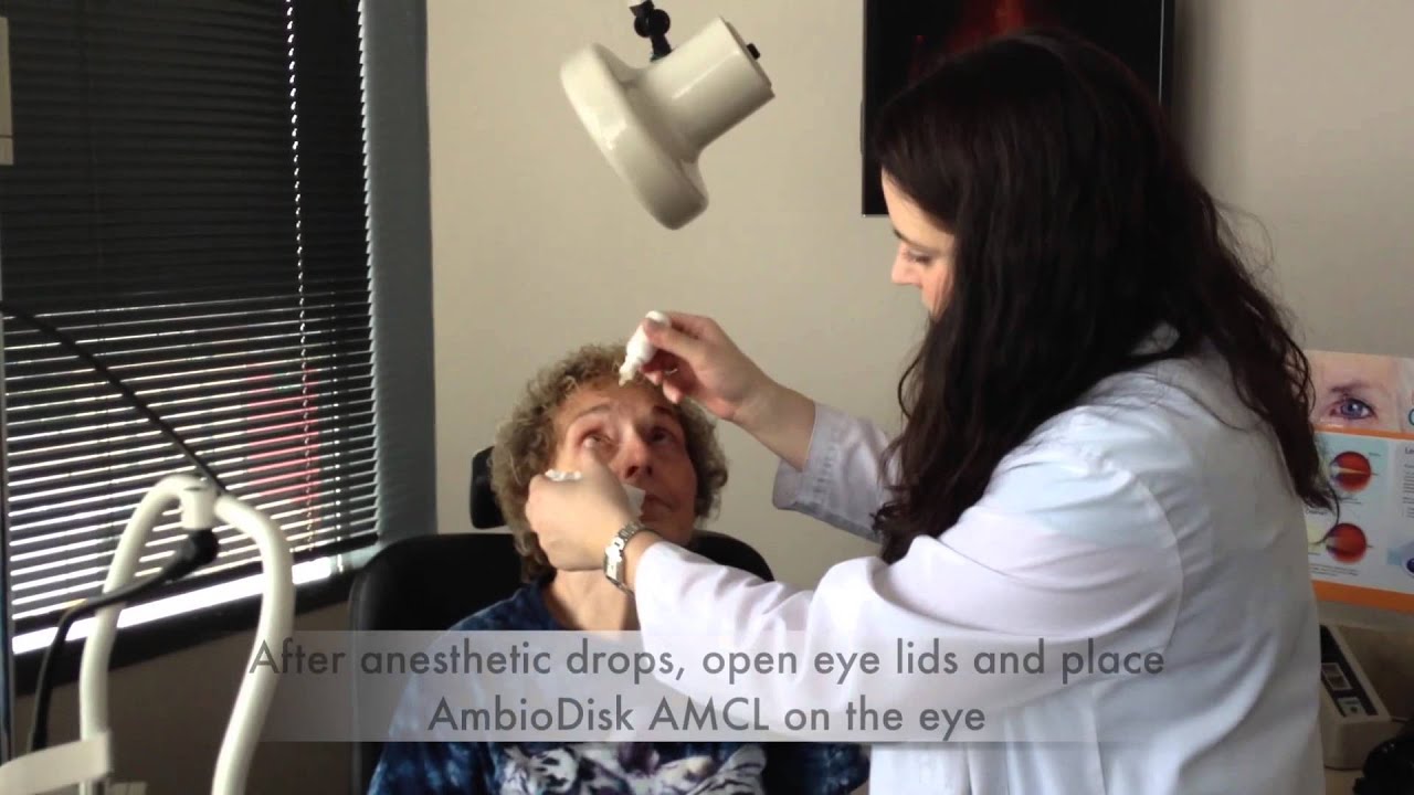 AmbioDisk amniotic membrane contact lens patient #7 - YouTube