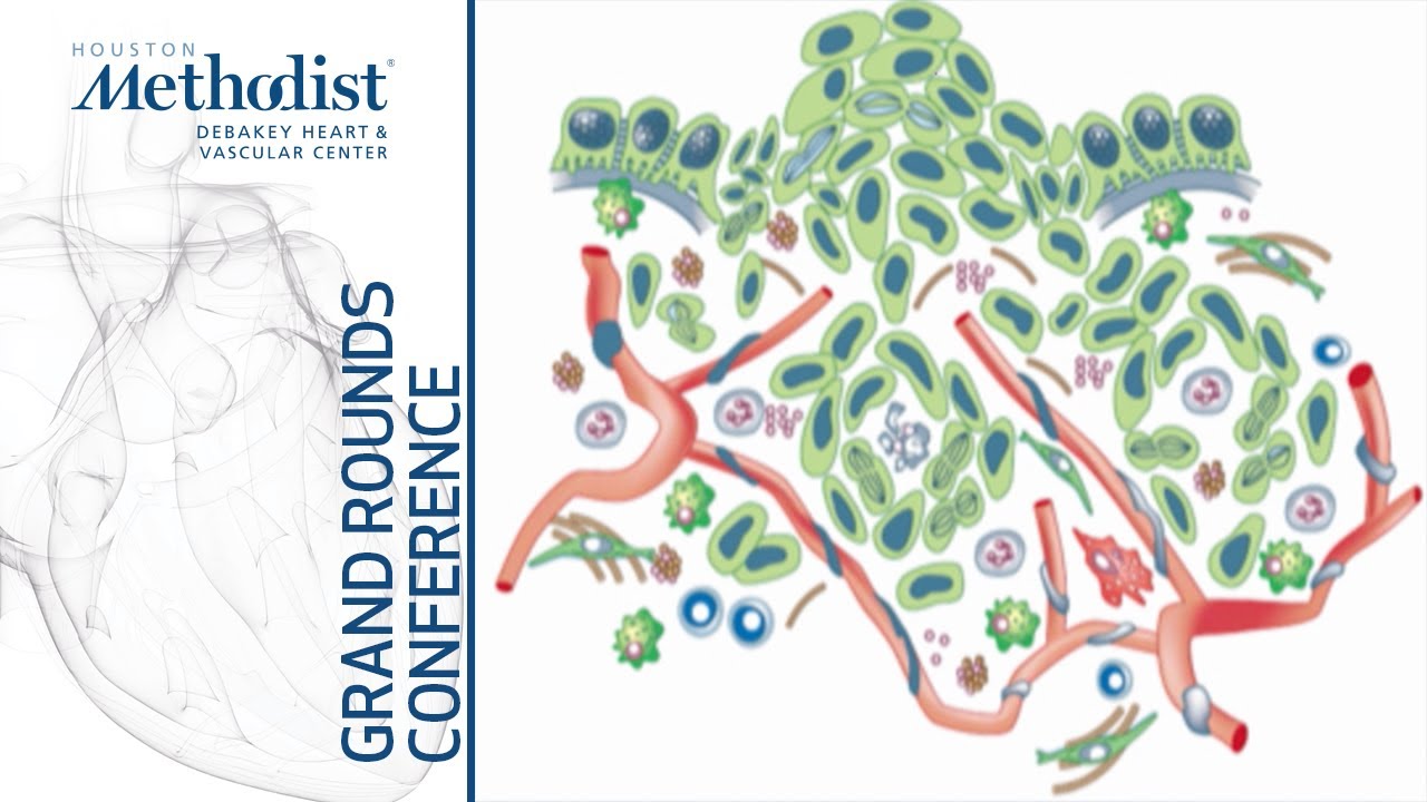 Inflammation & Atherosclerosis: Where have we been? Where are we going ...