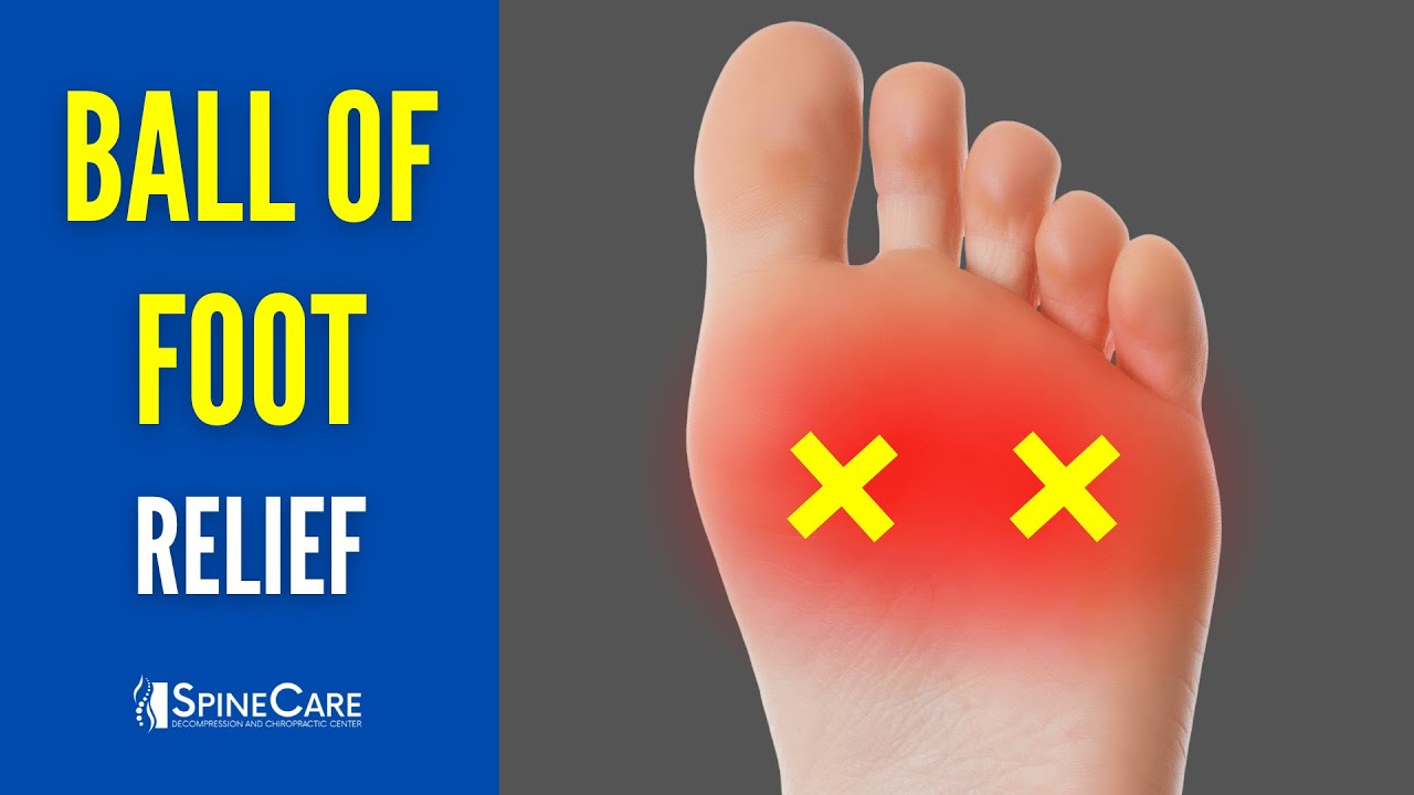 How to Relieve Ball of Foot Pain IN SECONDS - YouTube