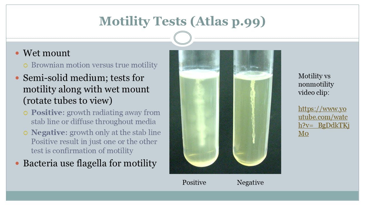 Motility Tests - Microbiology Class - Podcast (CC) - YouTube