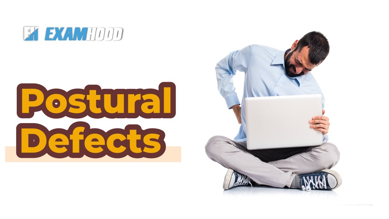 Postural Defects - YouTube