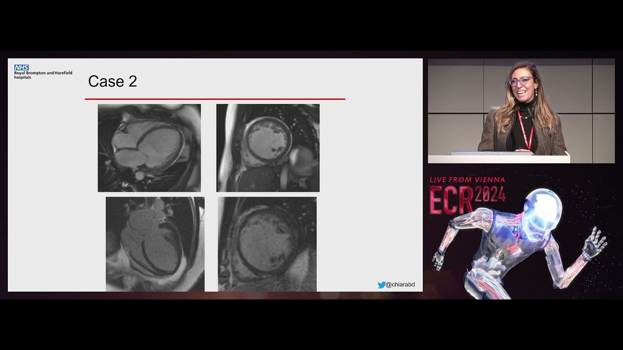 Multimodality Cardiac Imaging From Diagnosis To Therapy Planning Youtube